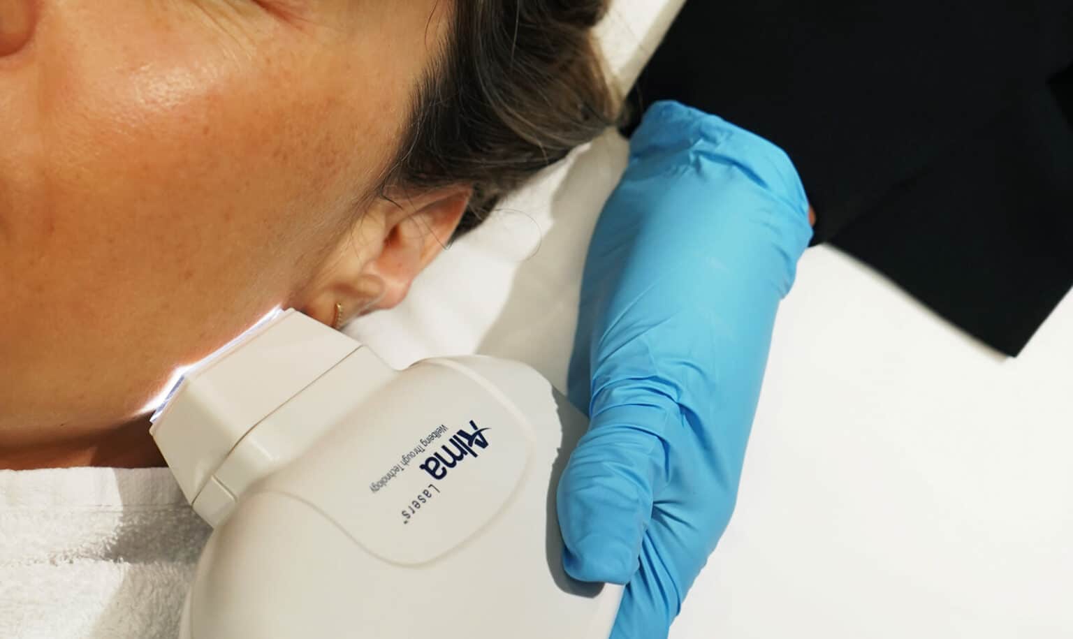 AFT for Acne | Project Skin MD®