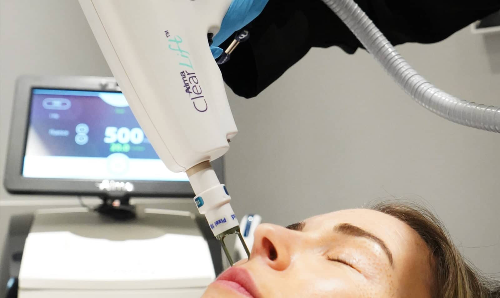 ClearLift Plus | Project Skin MD®