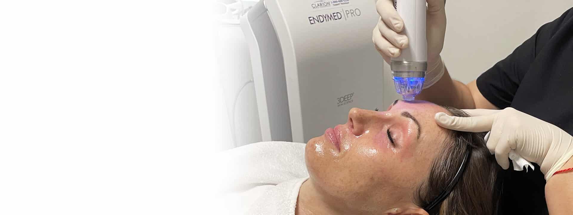 RF Microneedling | Project Skin MD®