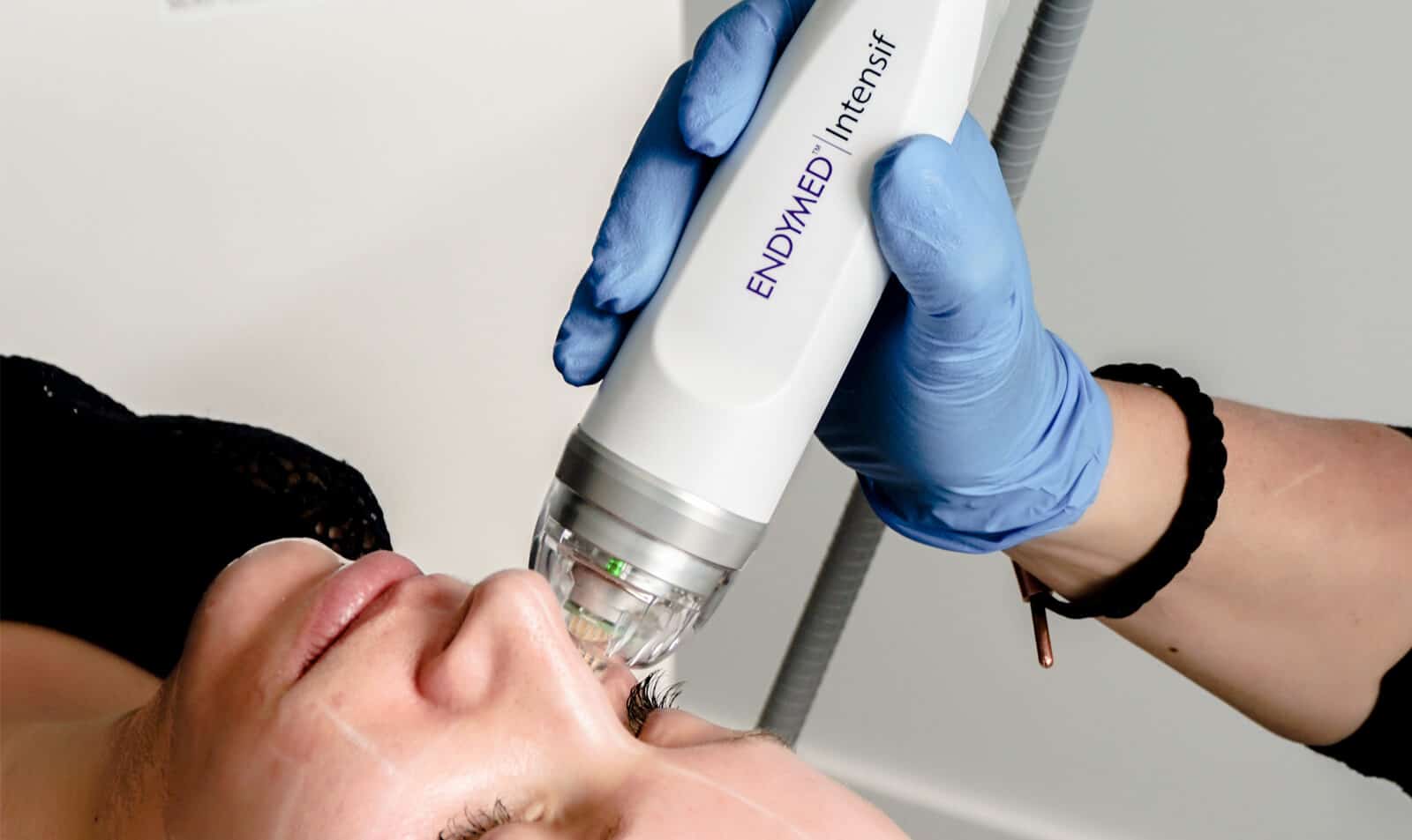 RF Microneedling | Project Skin MD®