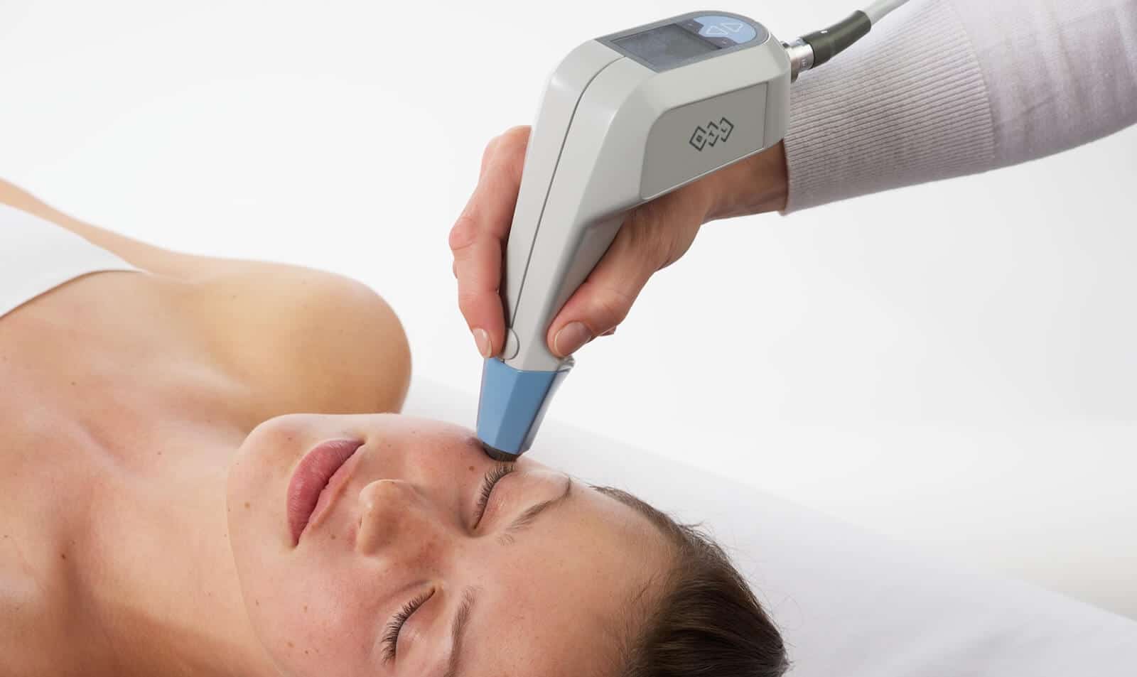 Exilis Ultra 360 Ottawa