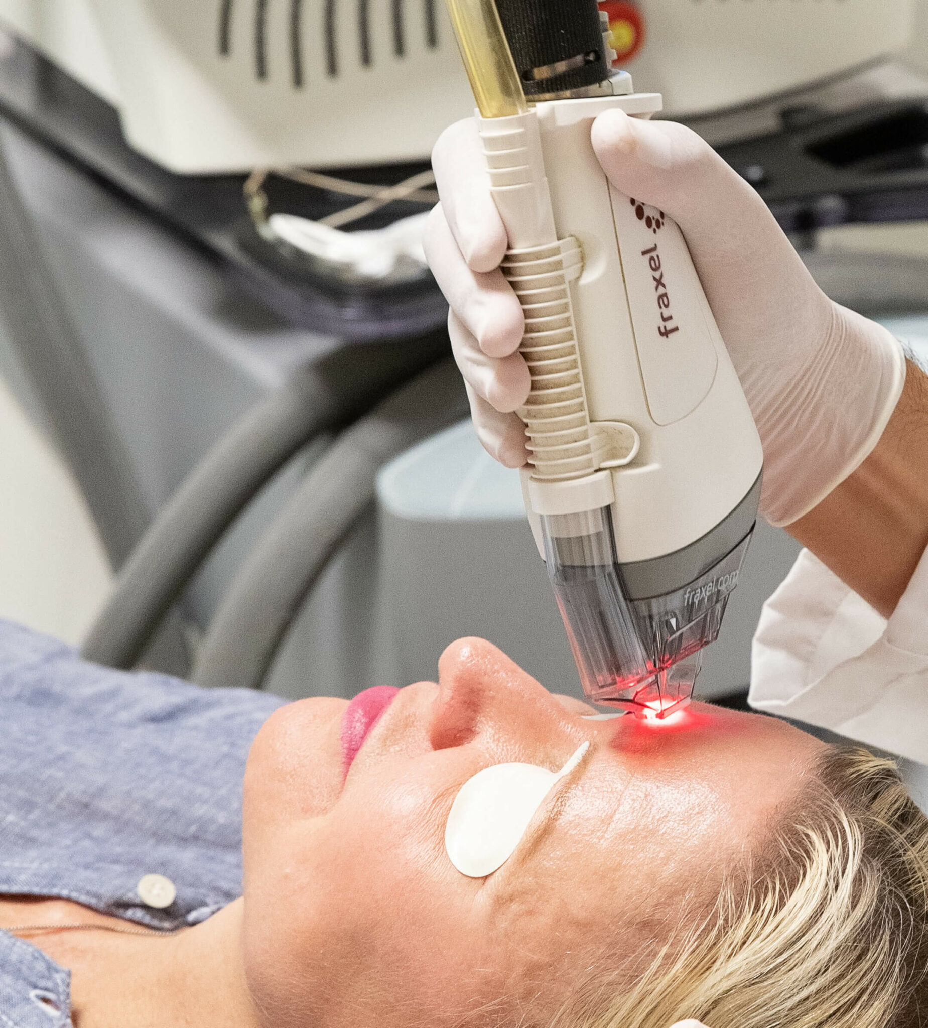 Treating Rosacea: Project Skin’s Janice Coplin Explains - Project Skin MD